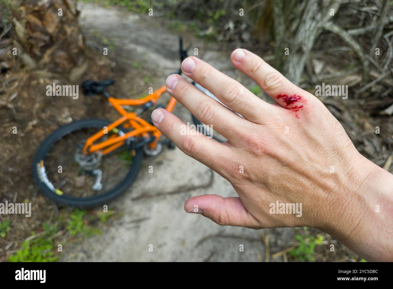 Arm injury while riding mountain bike on Florida jungle trails. Red ...