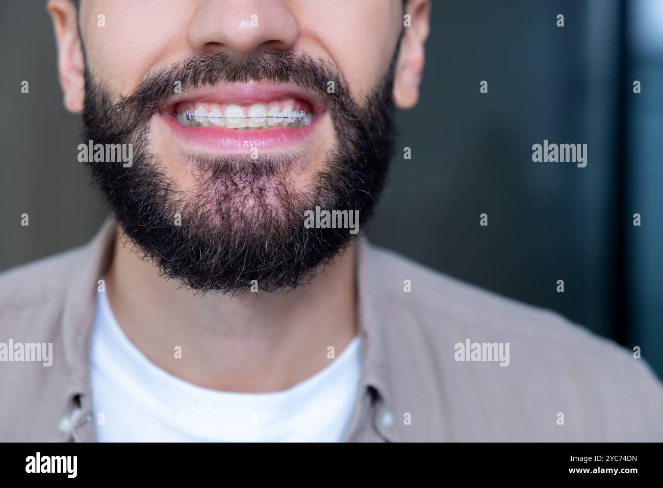 Ceramic lips hi-res stock photography and images - Alamy
