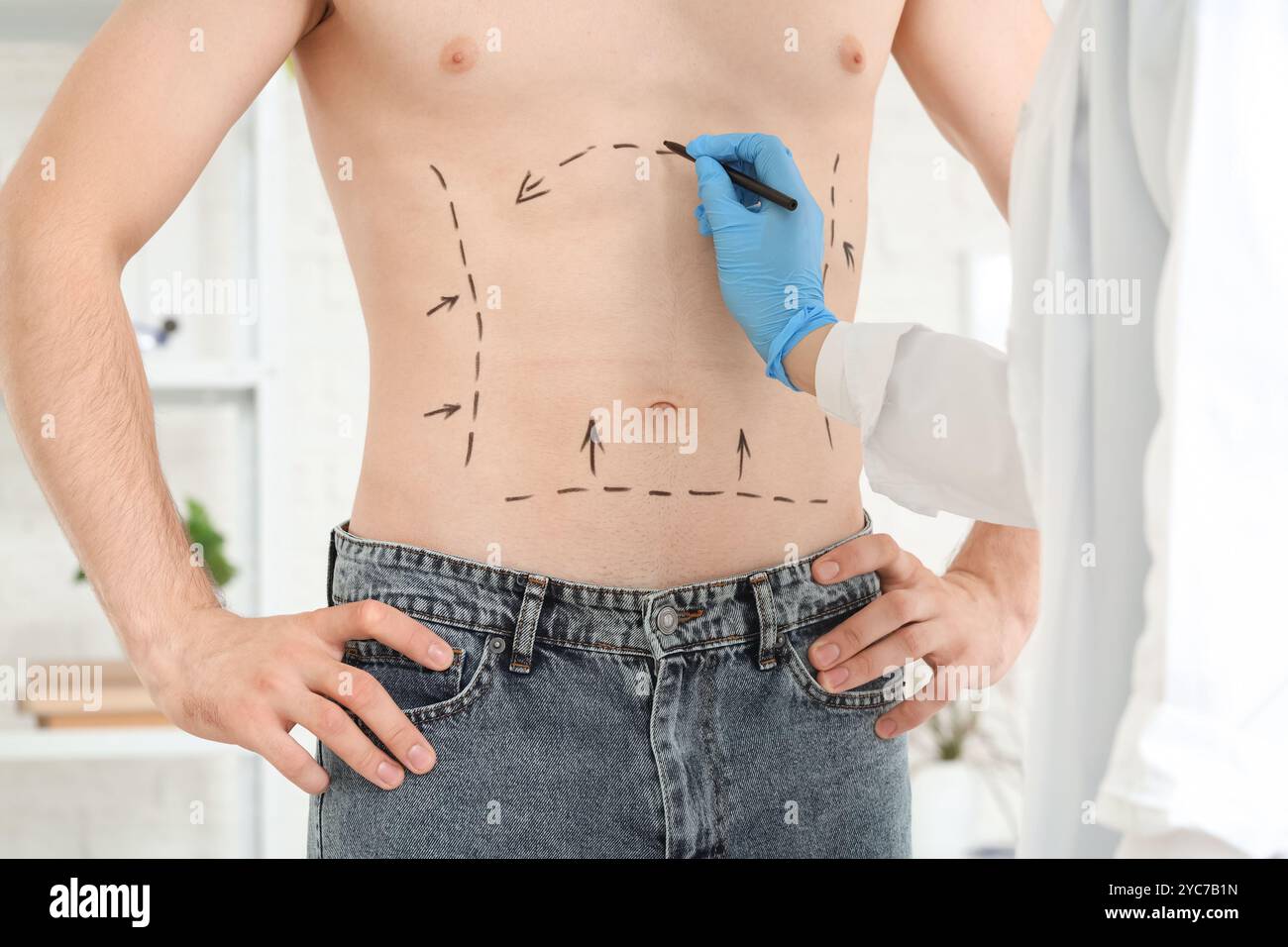 Female plastic surgeon marking man's belly in clinic, closeup Stock ...
