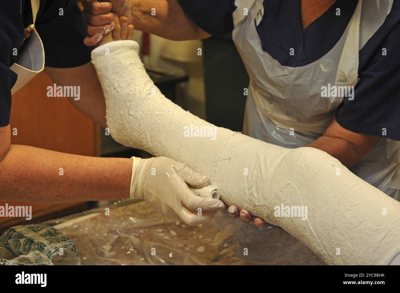 Hospital plaster cast leg hi-res stock photography and images - Alamy