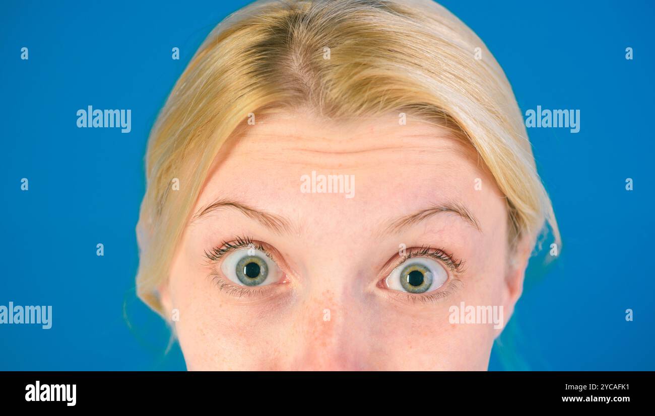 Woman wondering face show wrinkles on forehead. Skin care concept. Anti ...