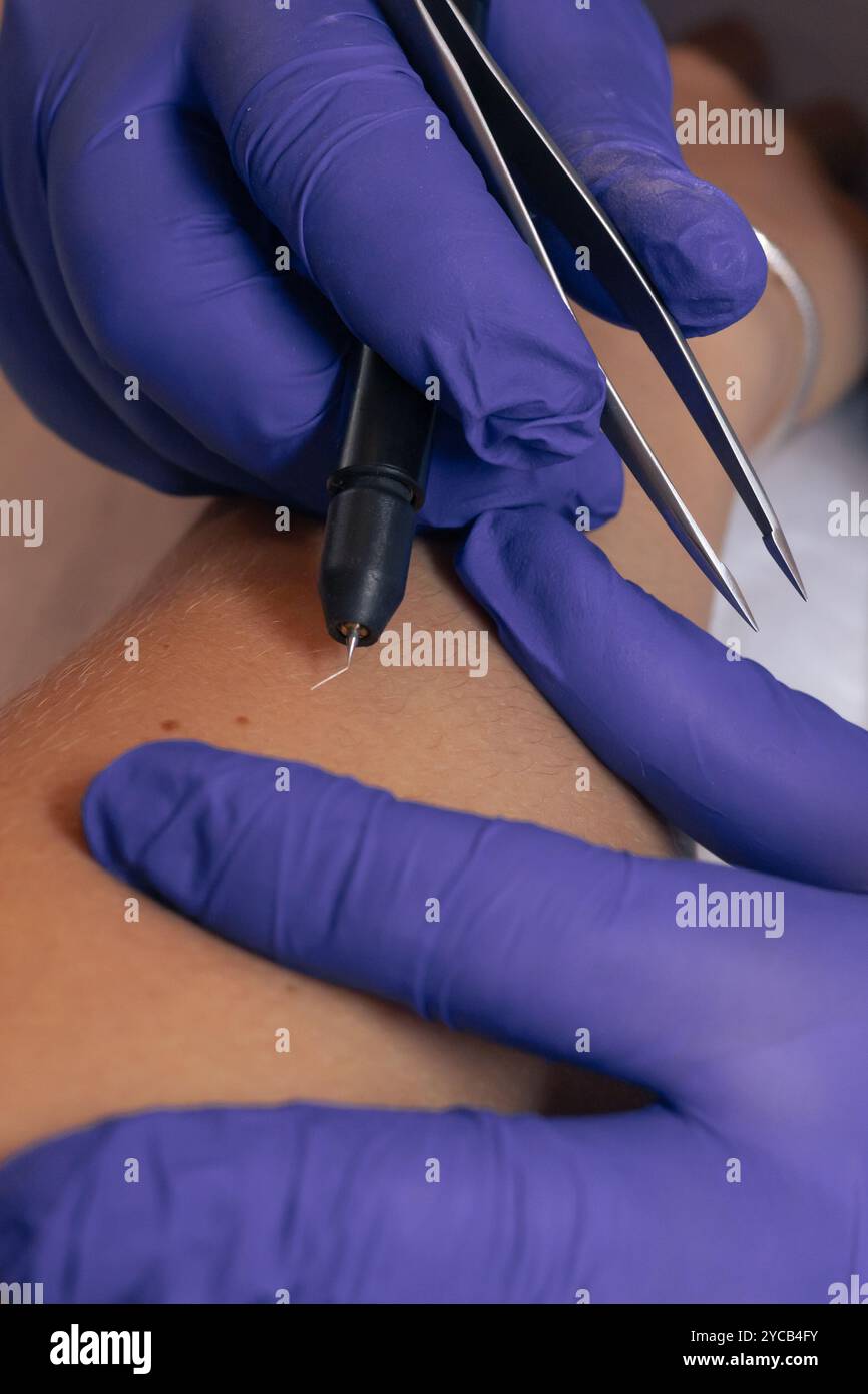 Health professional marking skin for a medical procedure at a clinical ...