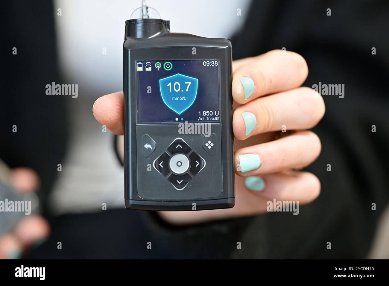 Insulin pumps for for diabetes. Diabetes is a condition in which the ...