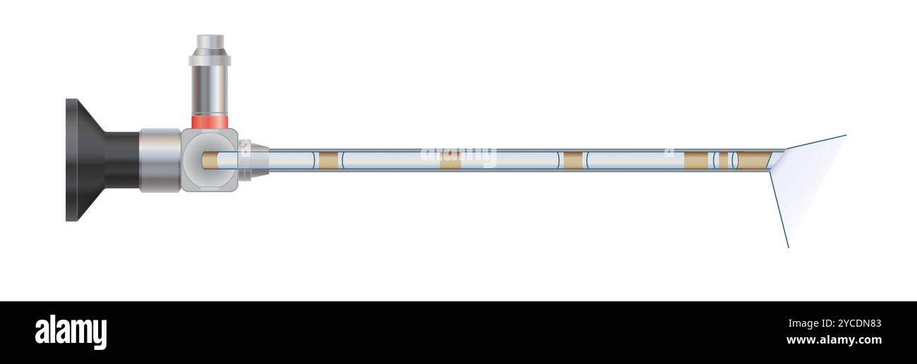 Illustration of a rigid endoscope. This is a type of endoscope used in ...
