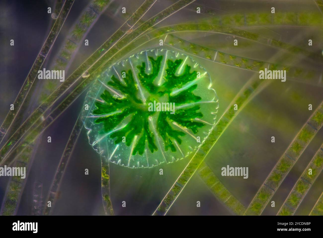 Darkfield light micrograph of a Micrasterias desmid captured amongst ...