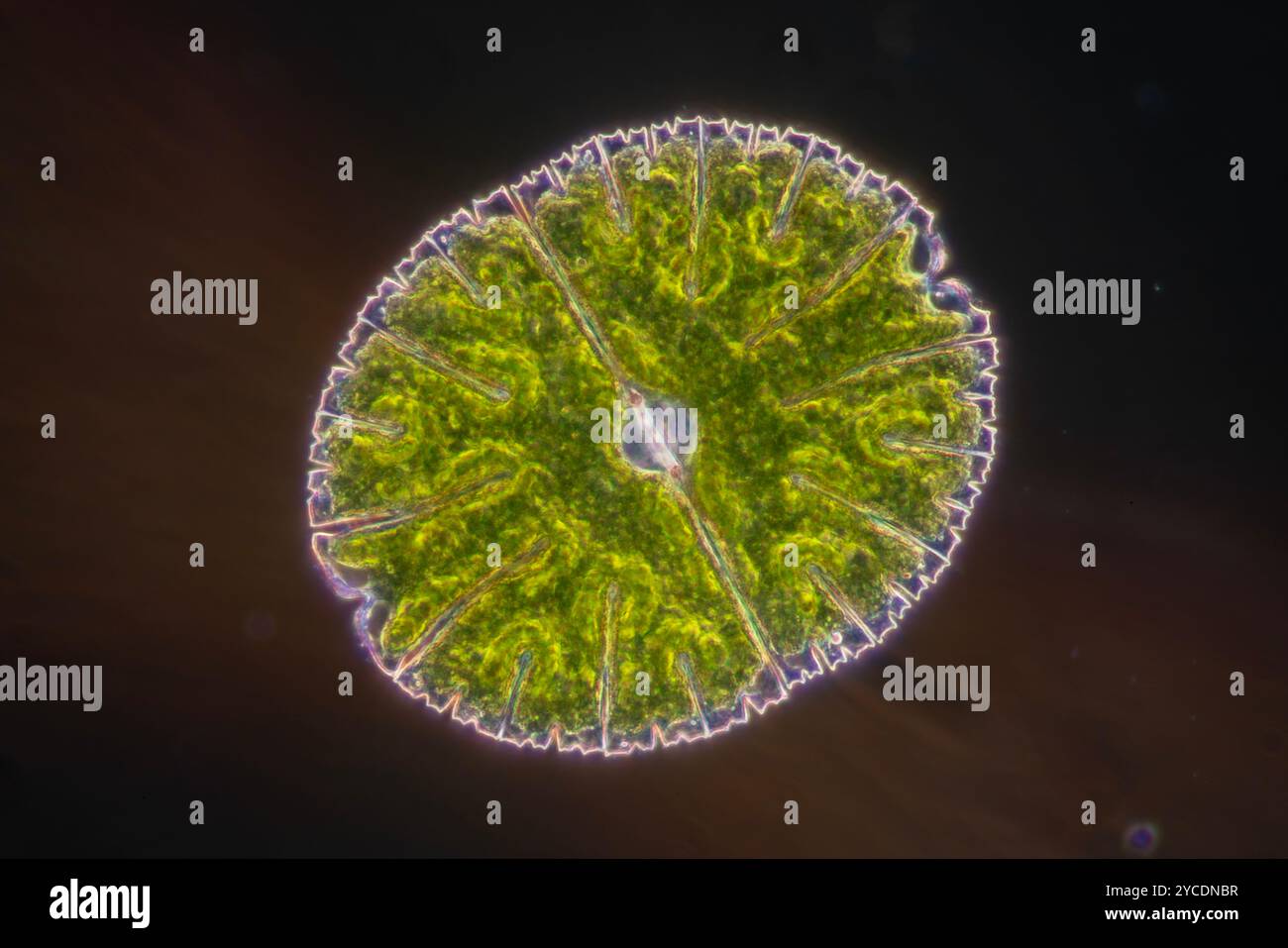 Phase contrast light micrograph of a Micrasterias desmid. Micrasterias ...
