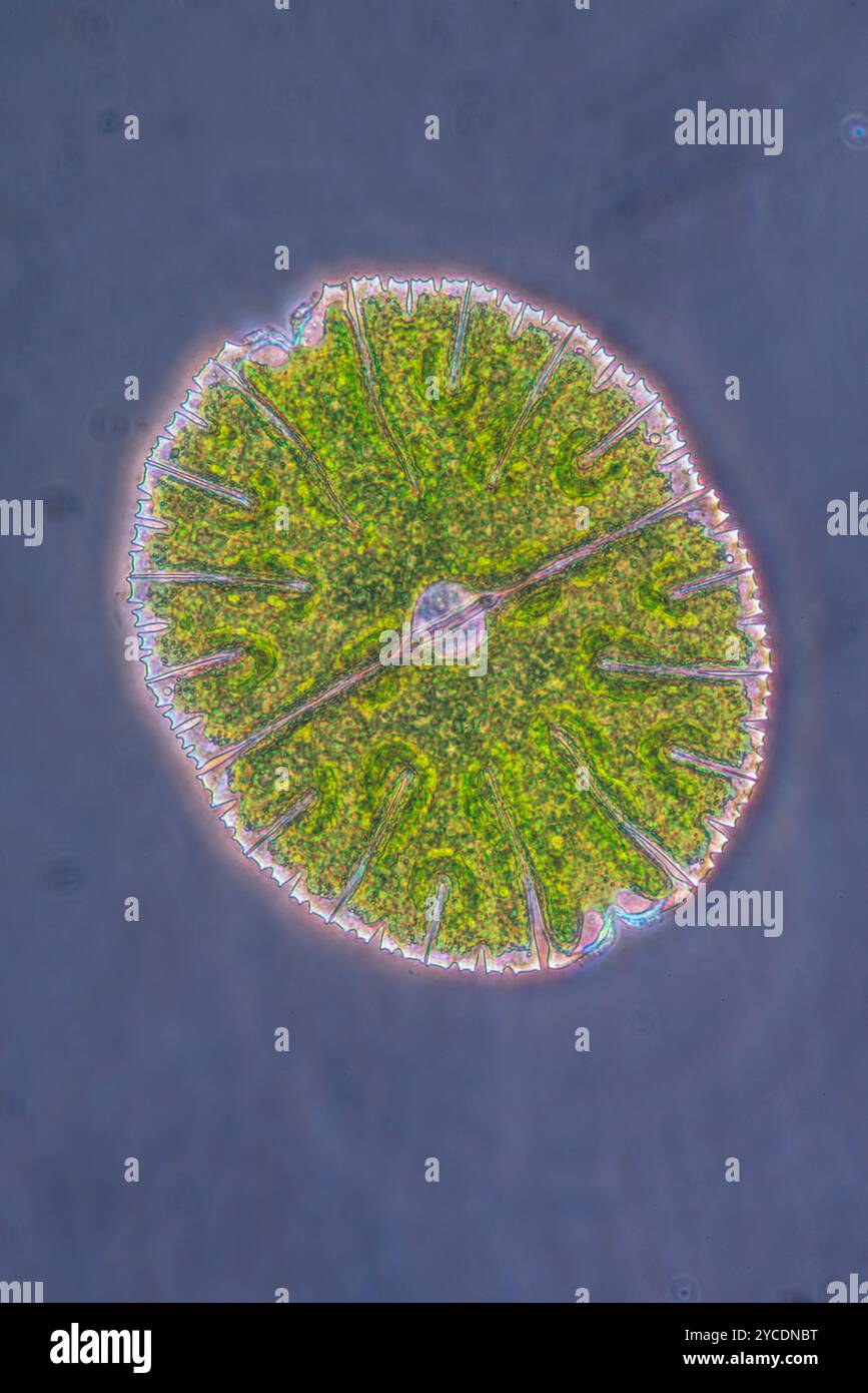 Phase contrast light micrograph of a Micrasterias desmid. The phase ...