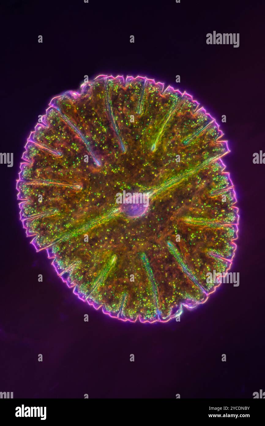 Phase contrast and polarised light micrograph of a Micrasterias desmid ...