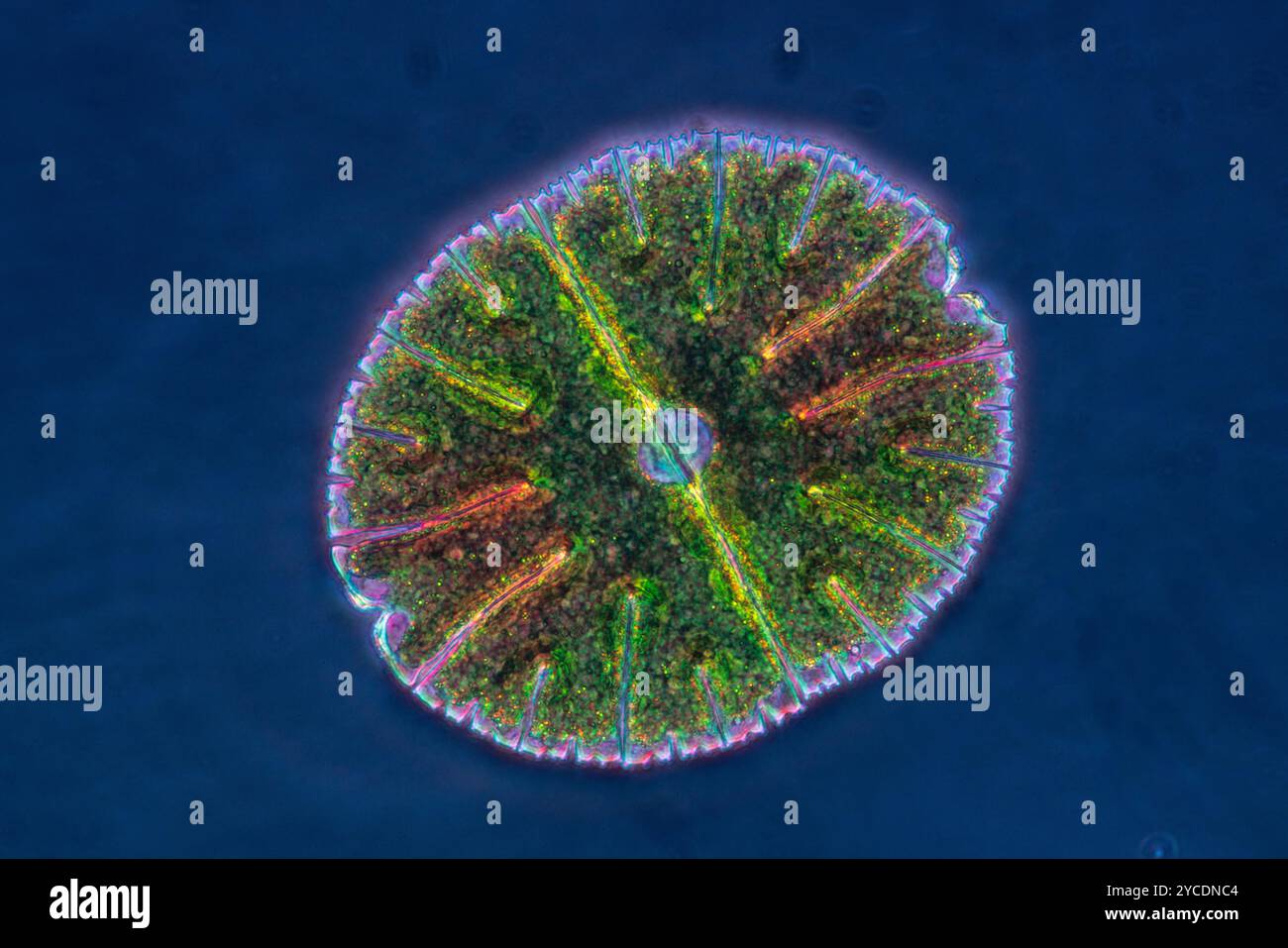 Phase contrast and polarised light micrograph of a Micrasterias desmid ...