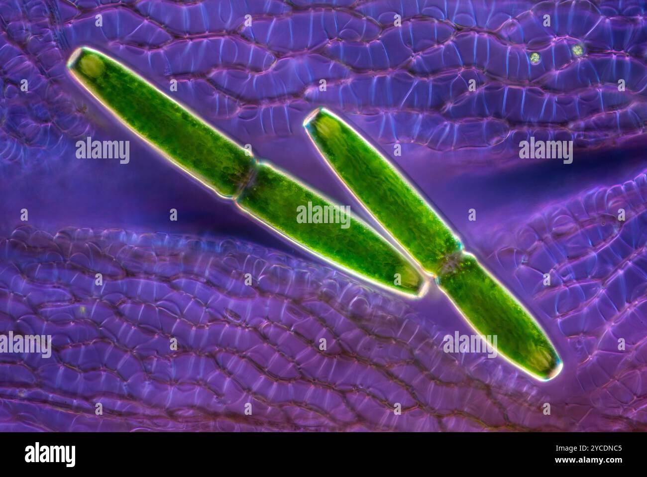 Darkfield and polarised light micrograph of a Pleurotaenium sp. desmid ...