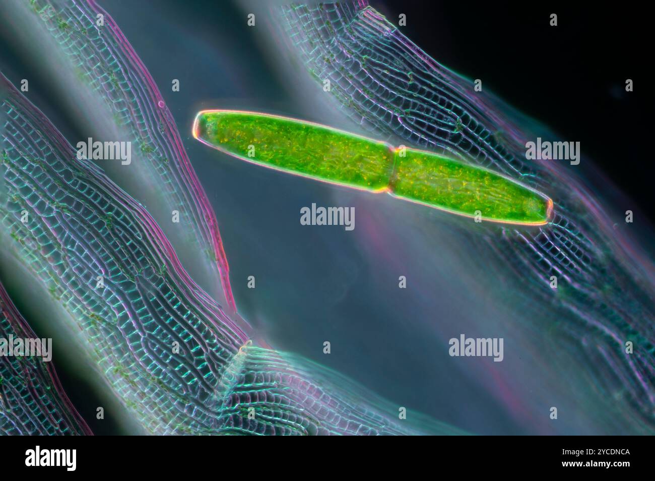 Darkfield light micrograph of a Pleurotaenium desmid nestled among the ...