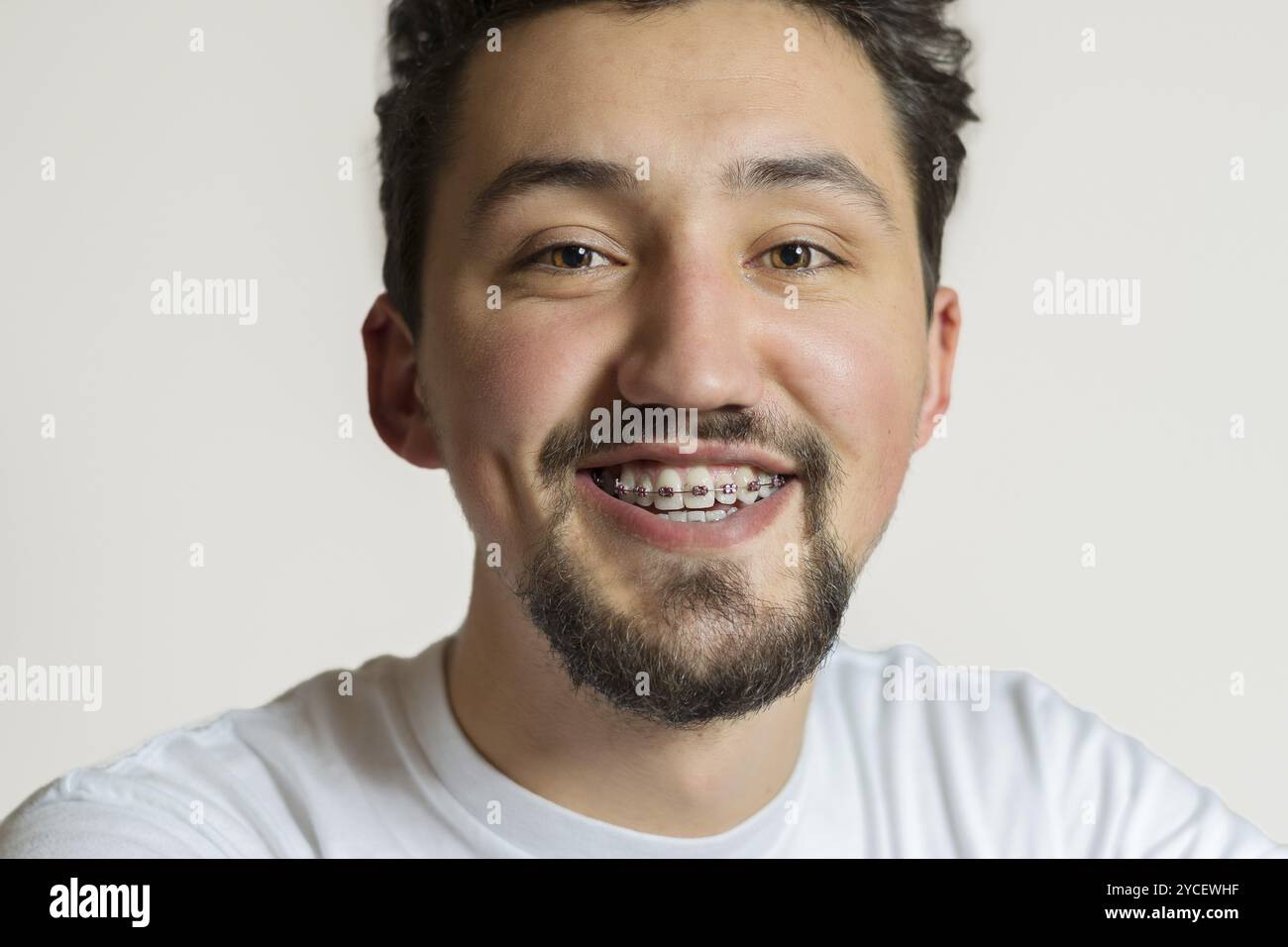 Portrait of a young man with braces smiling. A happy young man with ...