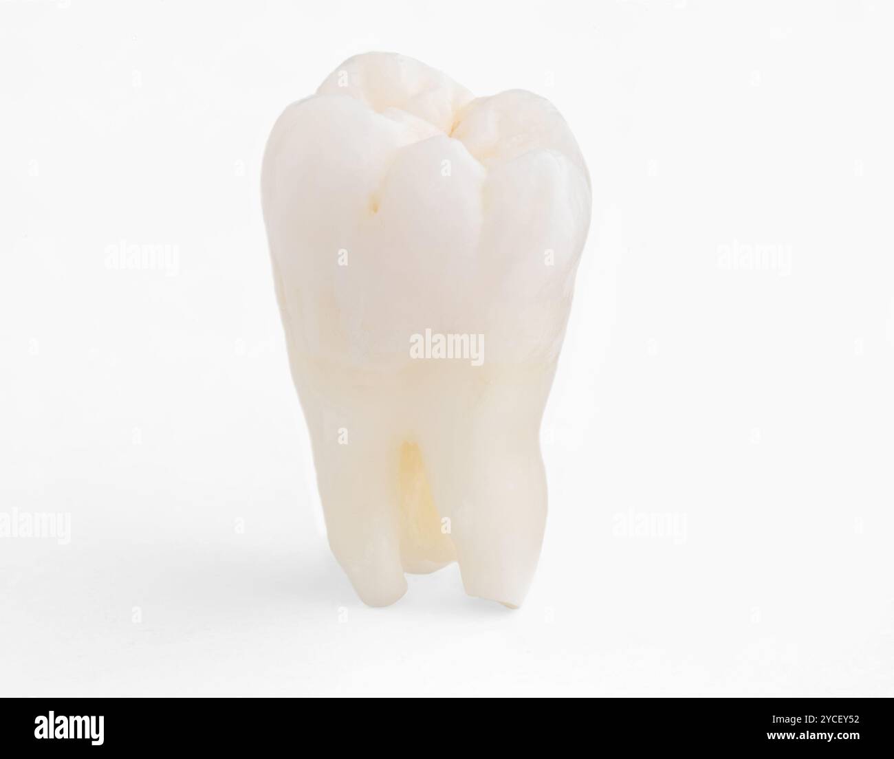 Real Human Wisdom tooth Stock Photo - Alamy