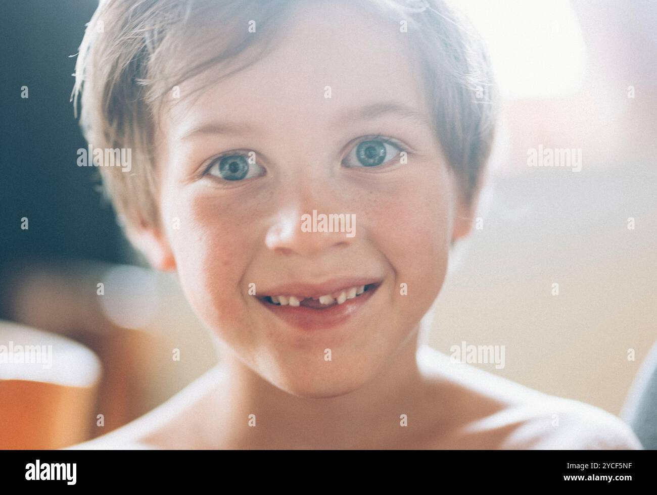 Boy with a gap in his teeth Stock Photo - Alamy