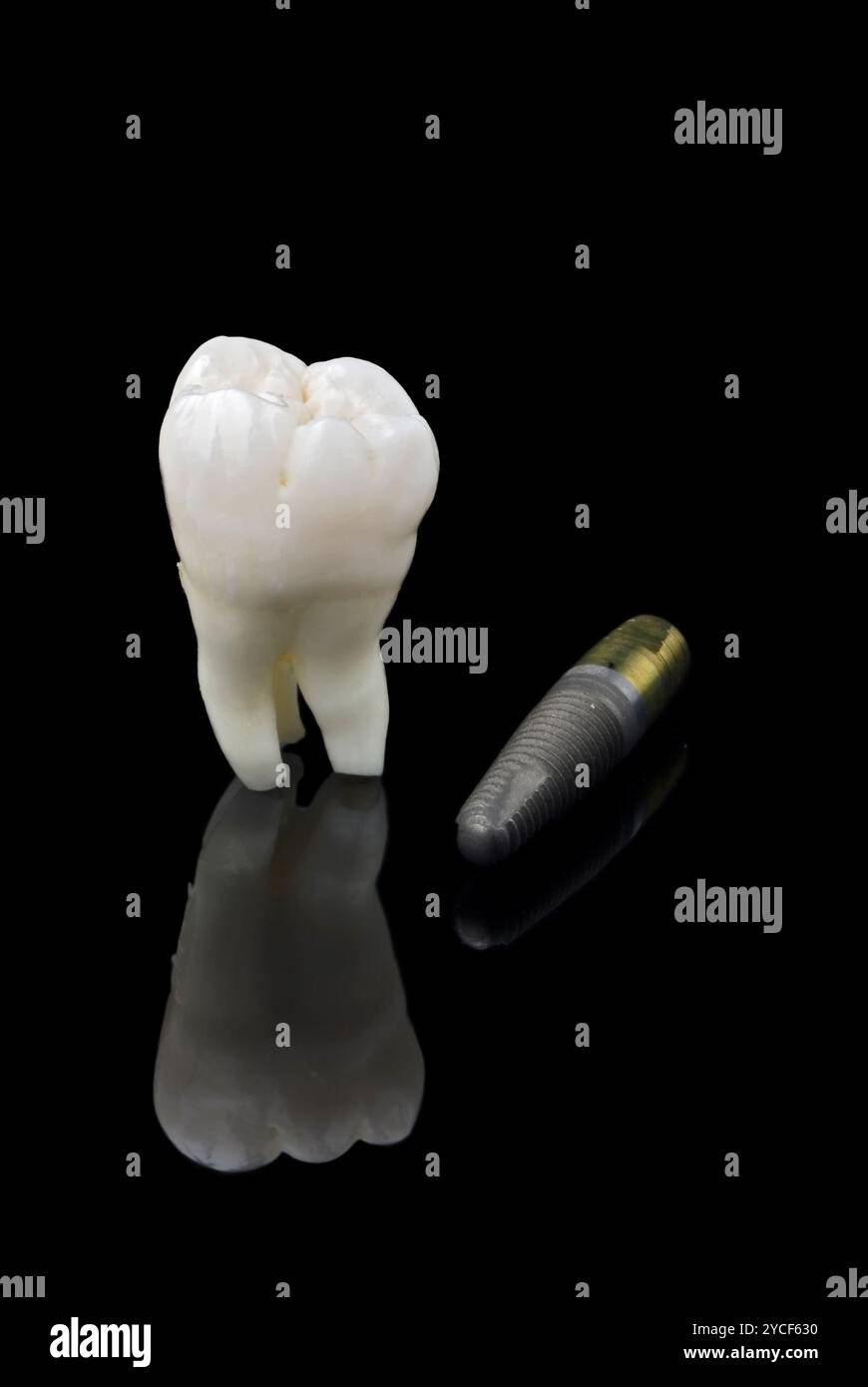 Human tooth and titanium implant Stock Photo - Alamy