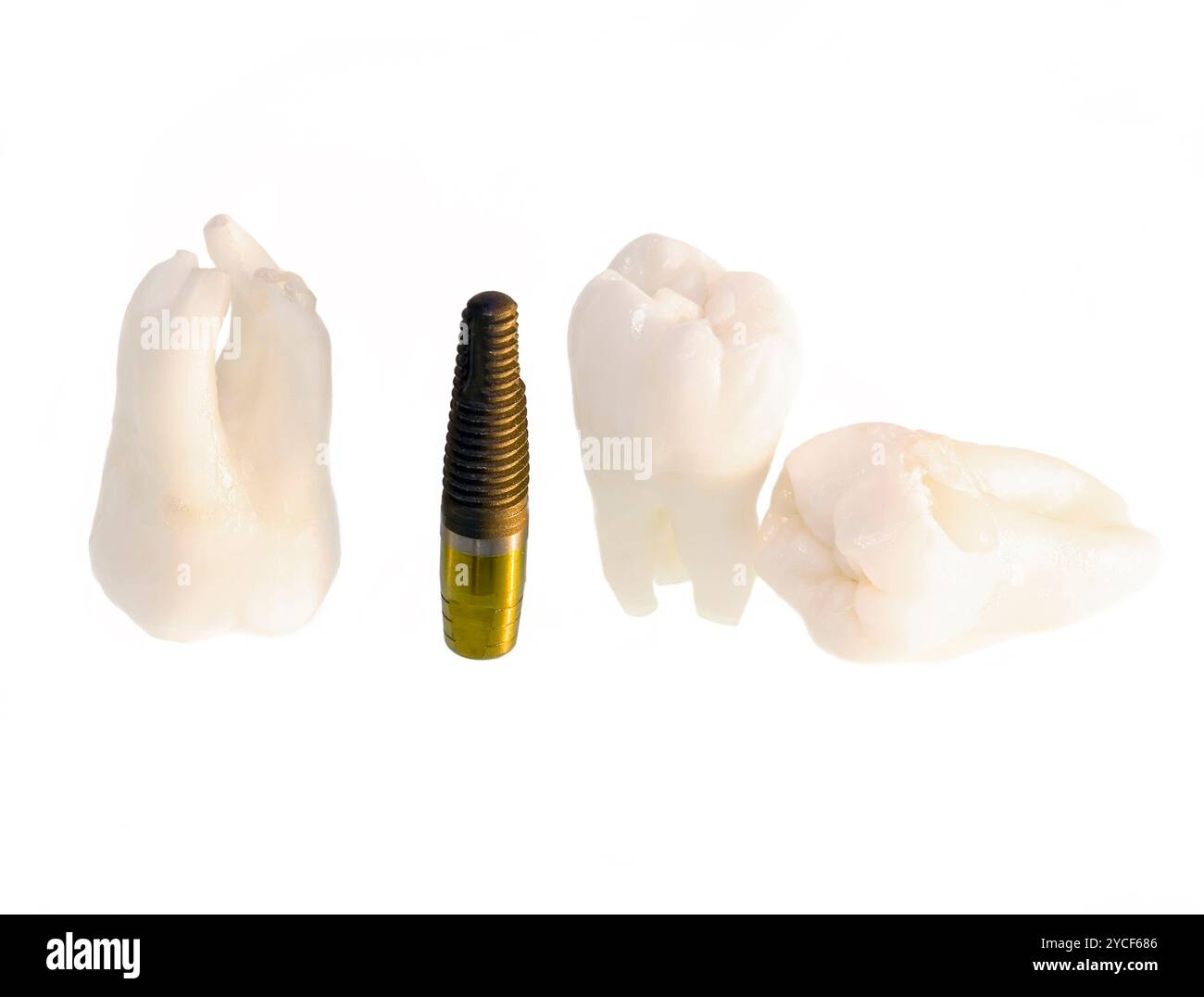 Wisdom teeth hi-res stock photography and images - Alamy