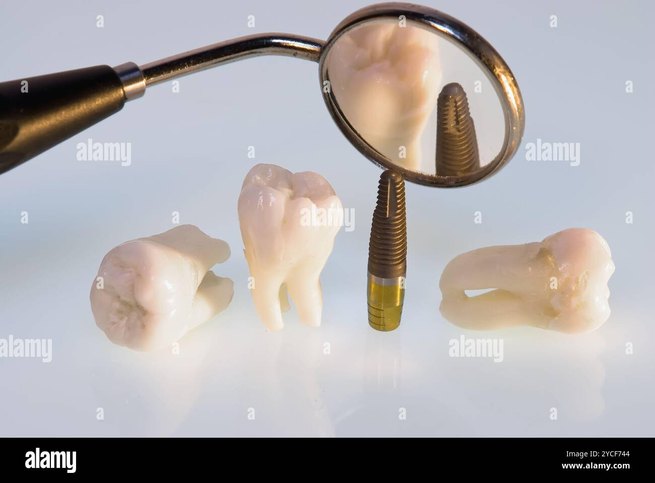 Wisdom teeth and dental implant Stock Photo - Alamy