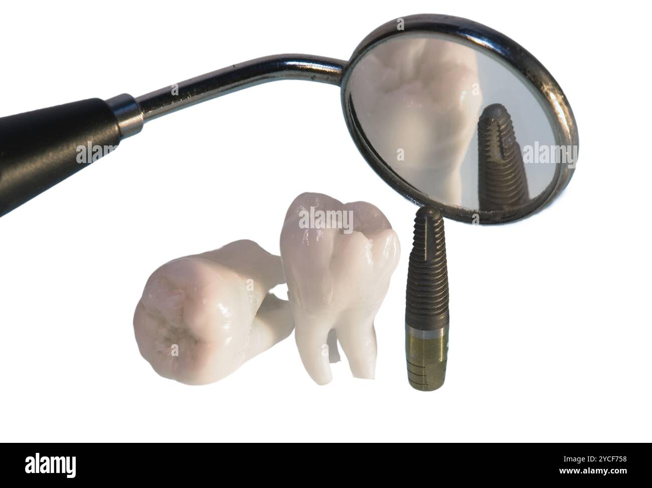 Wisdom teeth and dental implant Stock Photo - Alamy