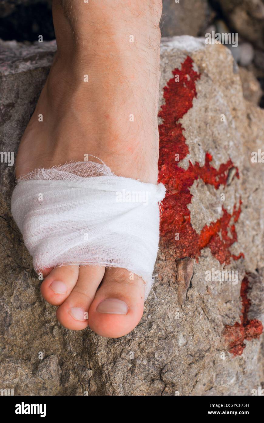 Medicine bandage on human injury foot and blood on rock Stock Photo - Alamy