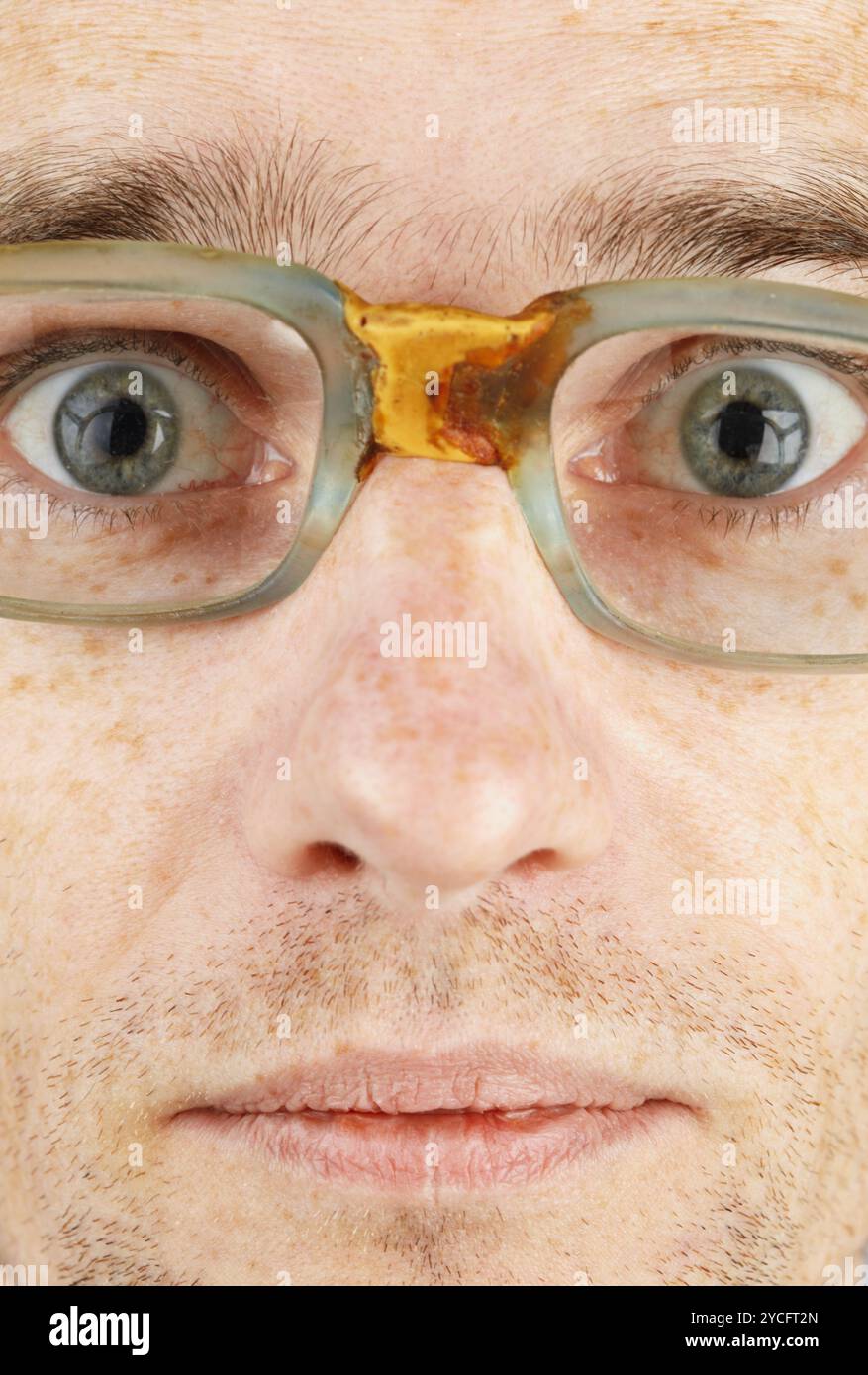 The person in old bad spectacles with a poor eyesight close up Stock ...