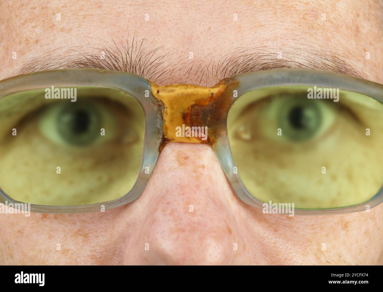 The person in old bad spectacles with a poor eyesight close up Stock ...