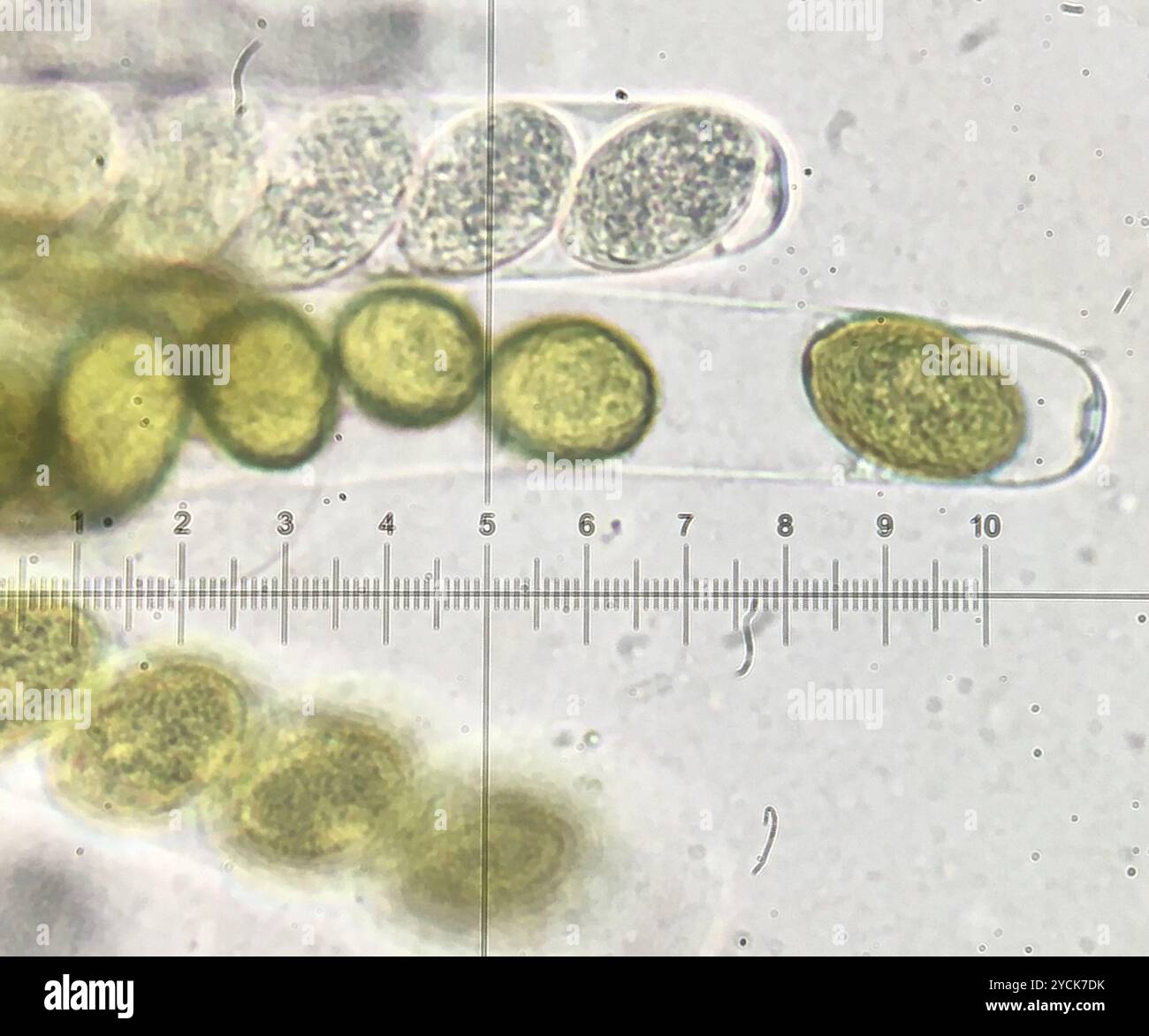 (Sordaria humana) Fungi Stock Photo - Alamy