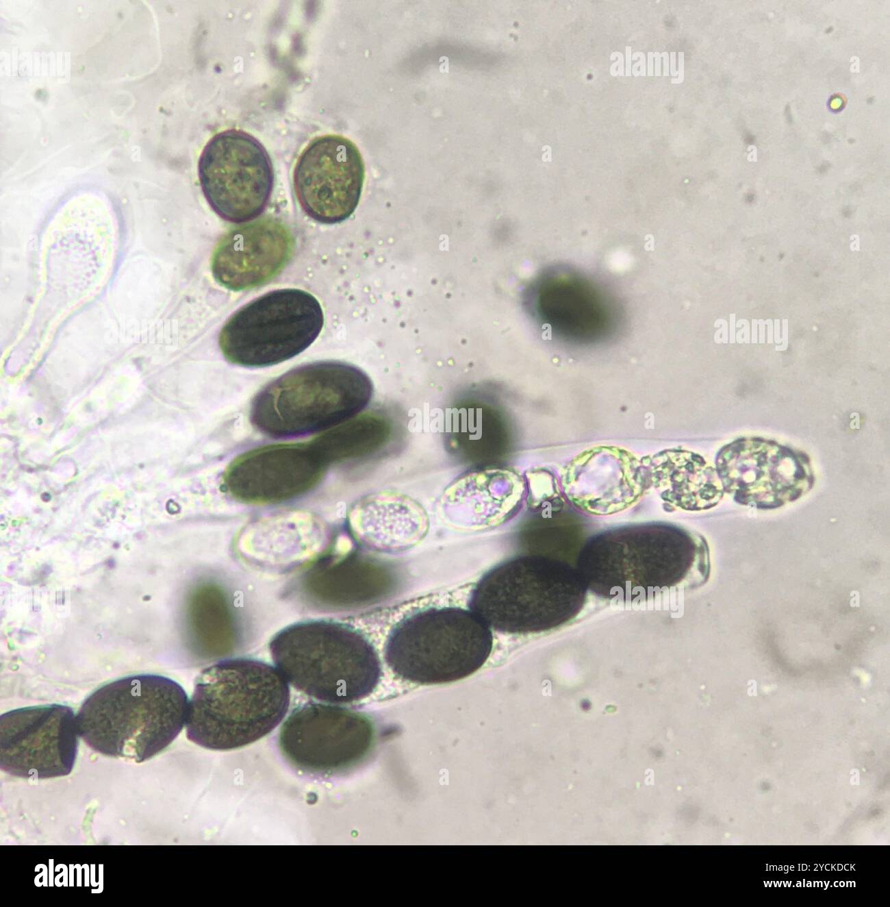 (Sordaria humana) Fungi Stock Photo - Alamy