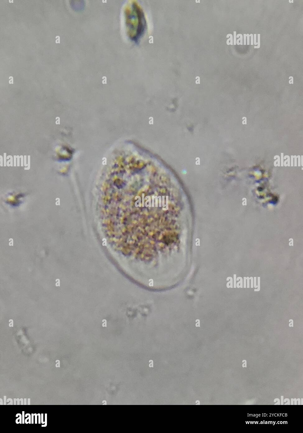 Amoebae (Amoebozoa) Protozoa Stock Photo - Alamy