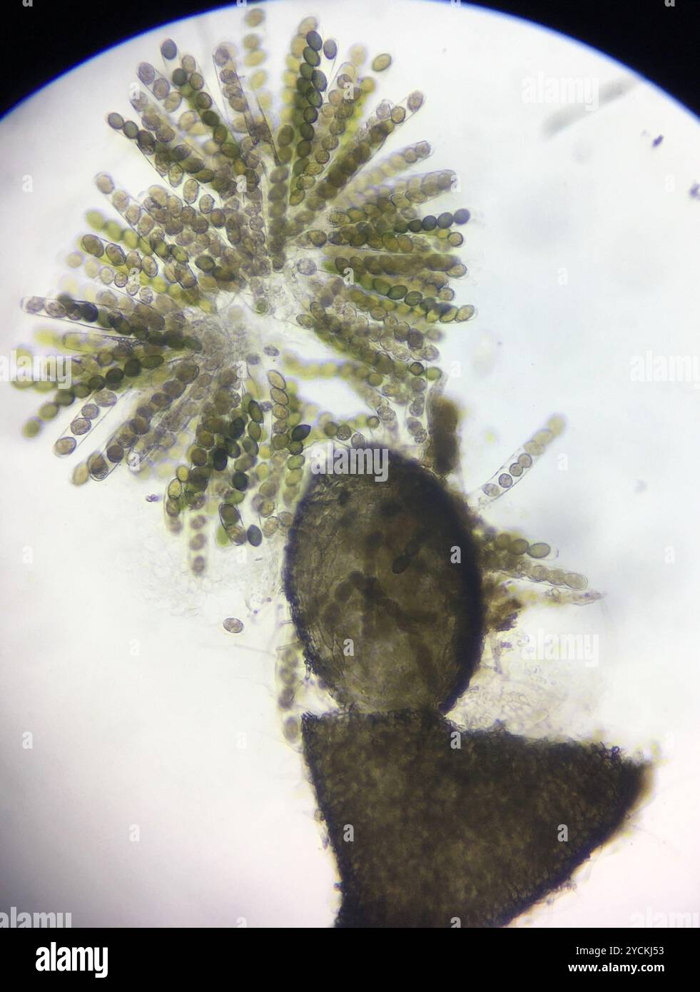 (Sordaria humana) Fungi Stock Photo - Alamy