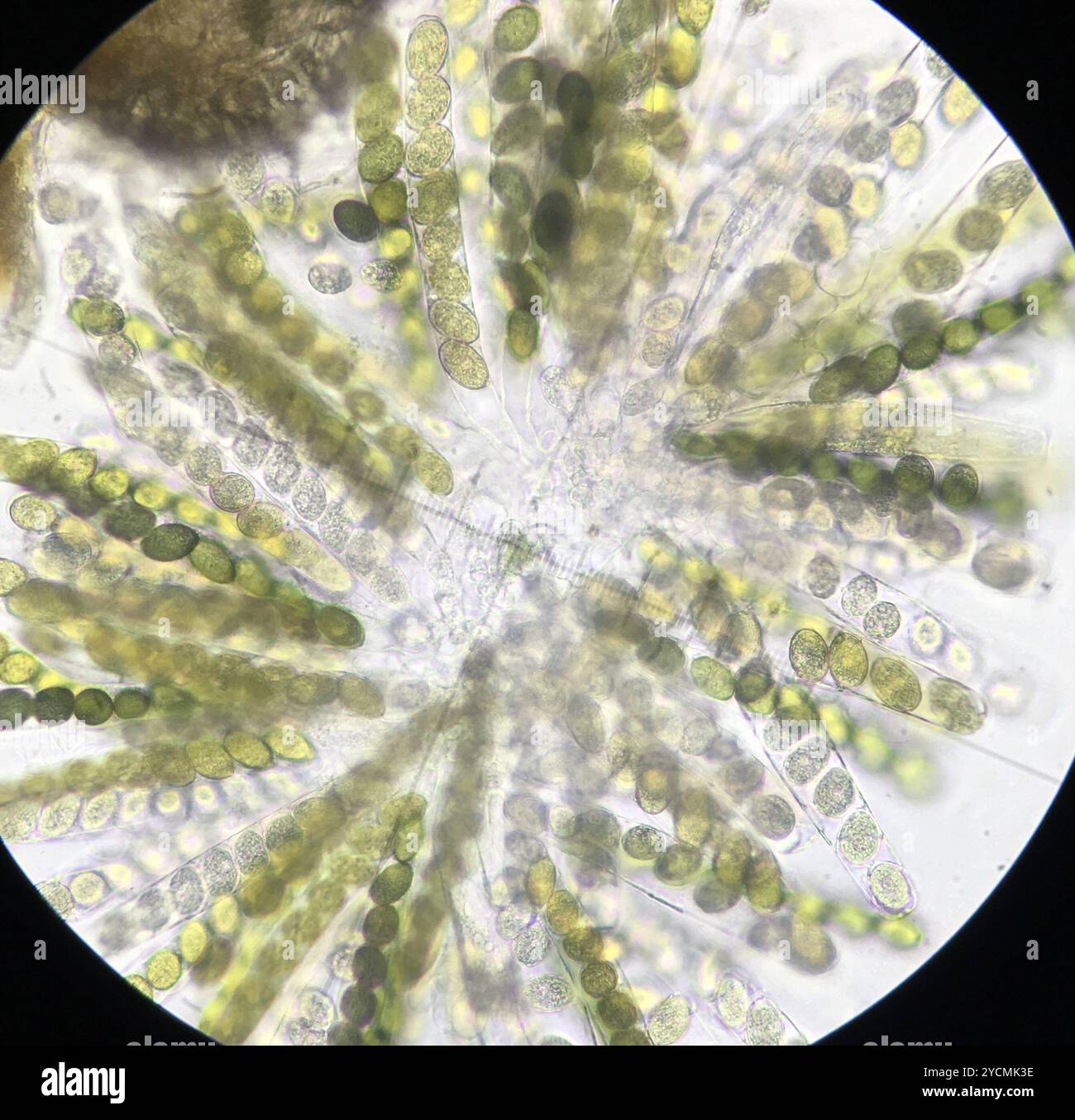 (Sordaria humana) Fungi Stock Photo - Alamy