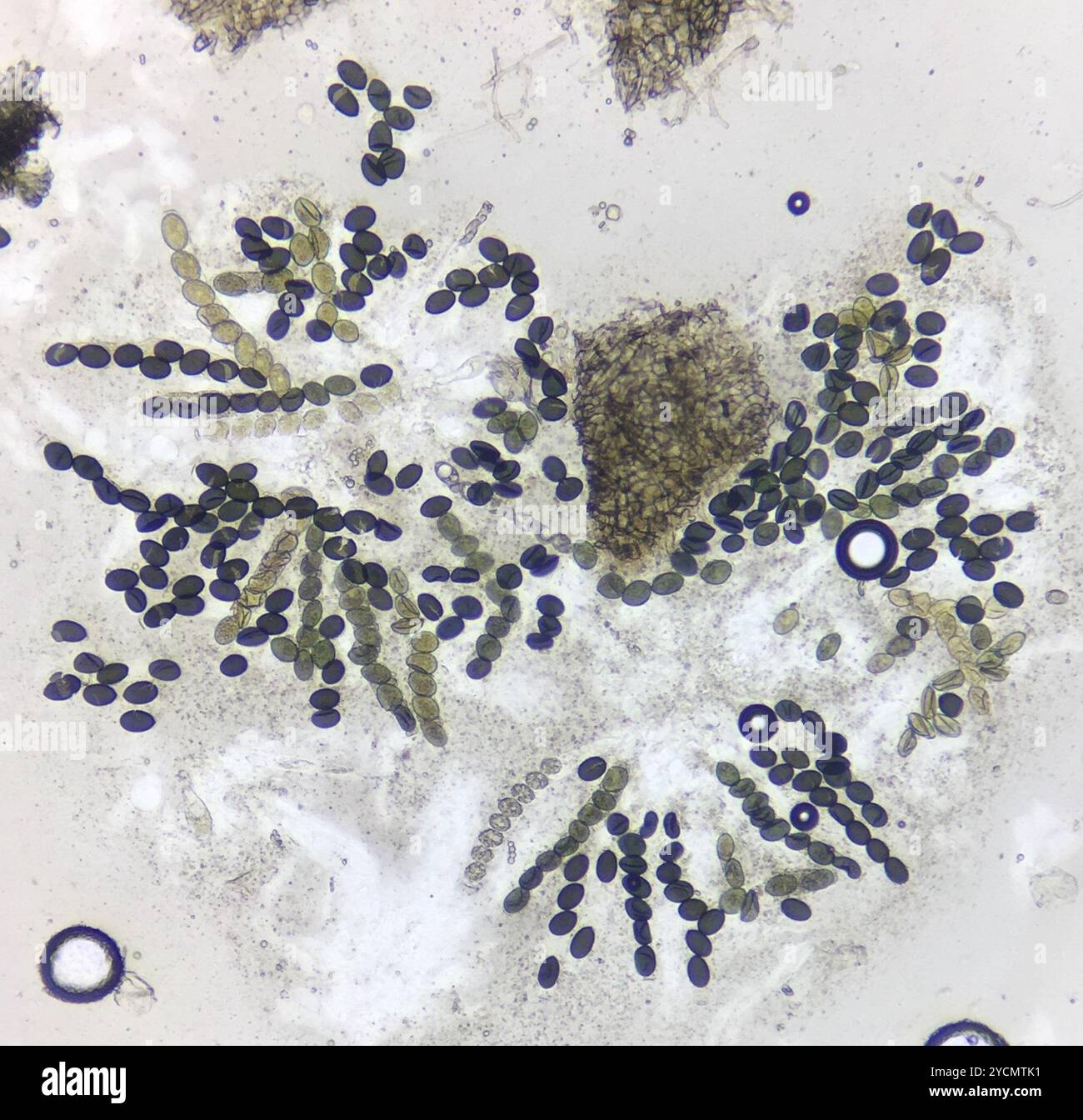 (Sordaria humana) Fungi Stock Photo - Alamy