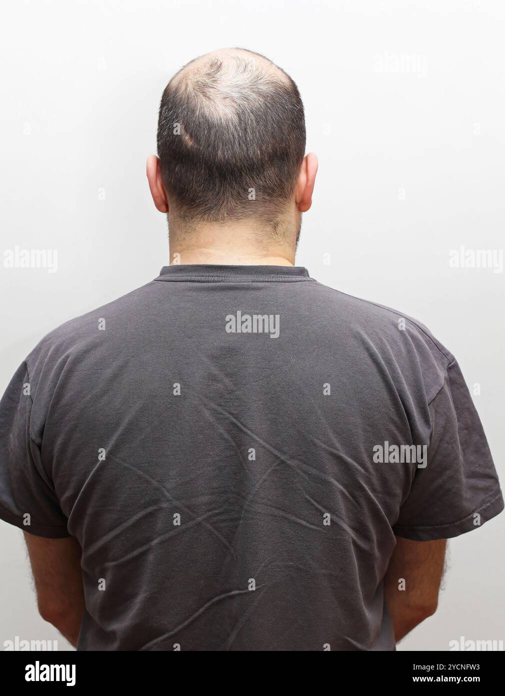 Bald head back hi-res stock photography and images - Alamy