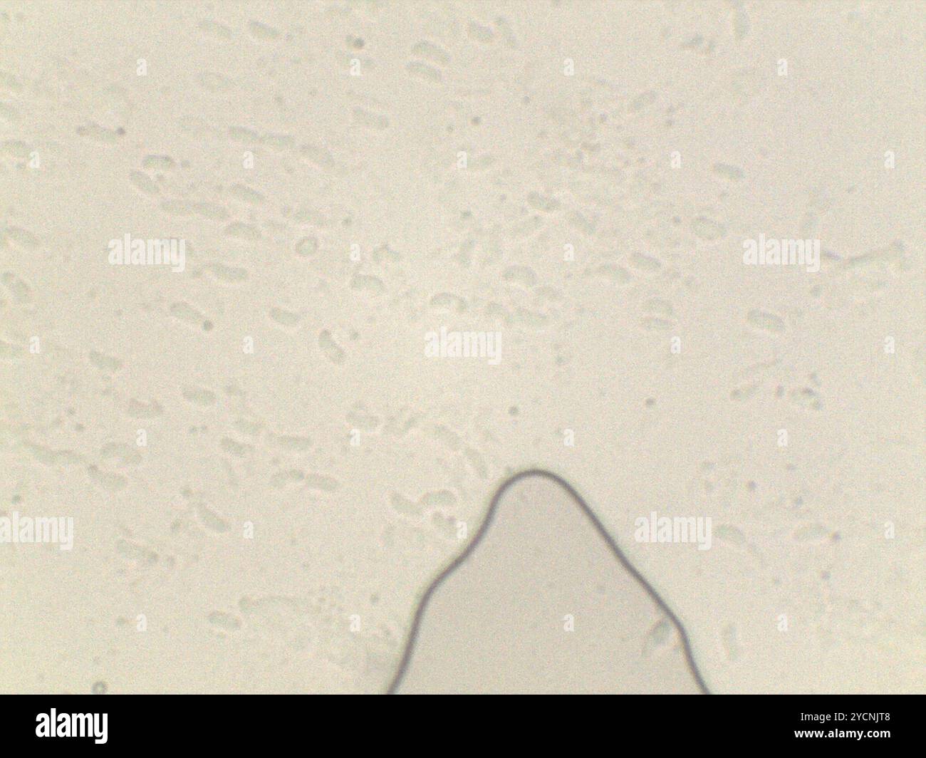 Athelia hi-res stock photography and images - Alamy