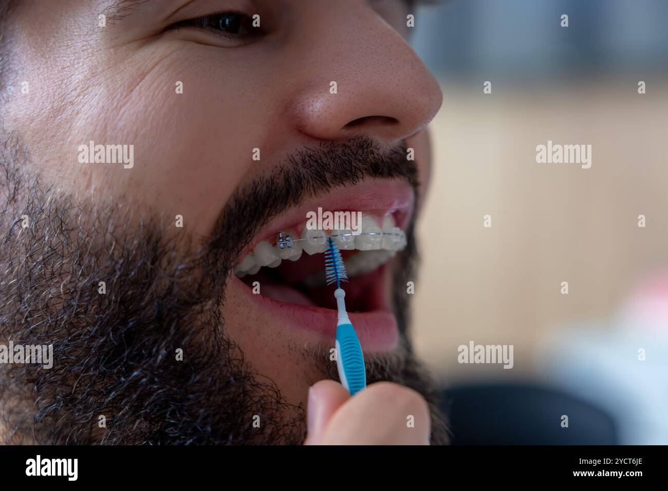 Man with metal braces carefully cleaning his teeth using interdental ...