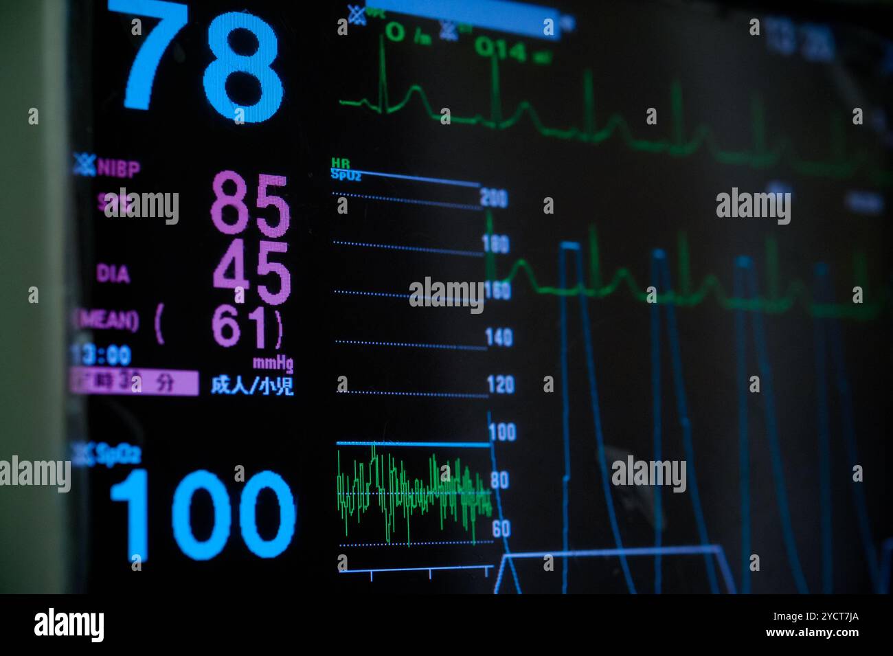 Vital sensor screen Stock Photo - Alamy