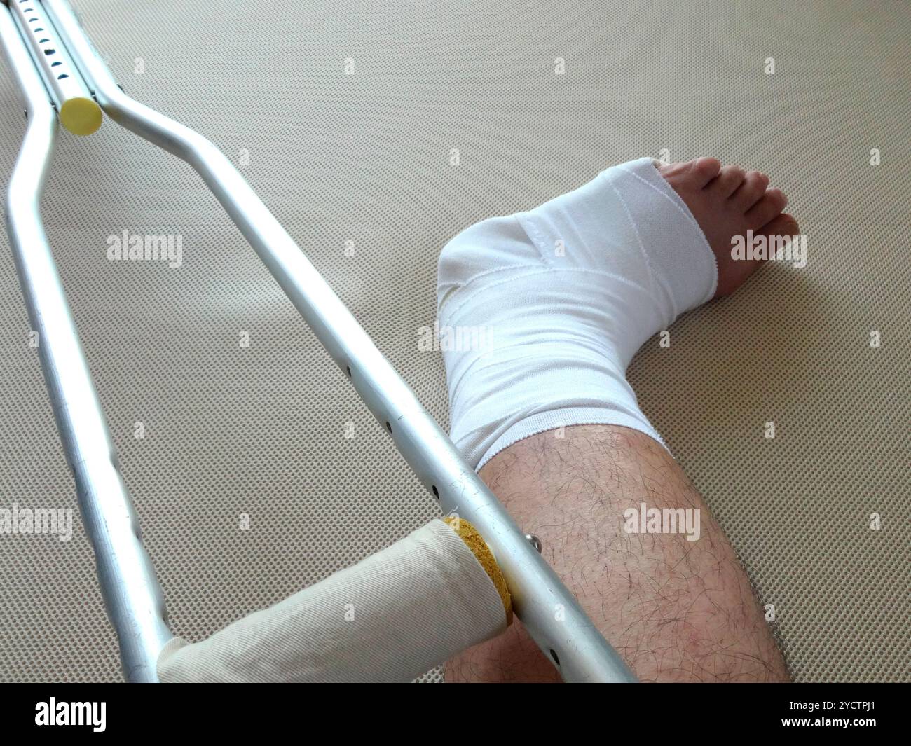 Bone fracture hi-res stock photography and images - Alamy