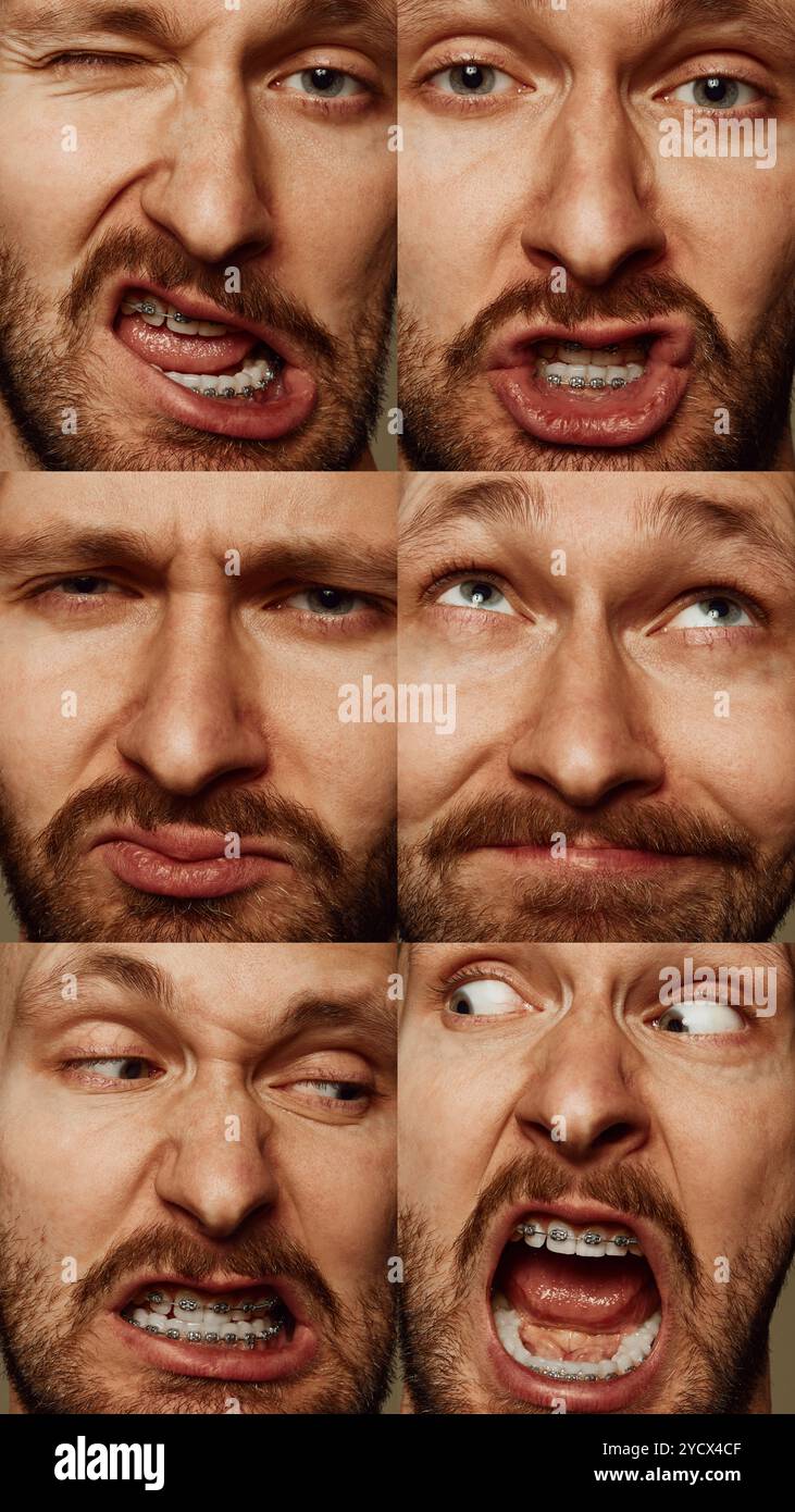 Collage of bearded young man with braces, featuring range of humorous ...
