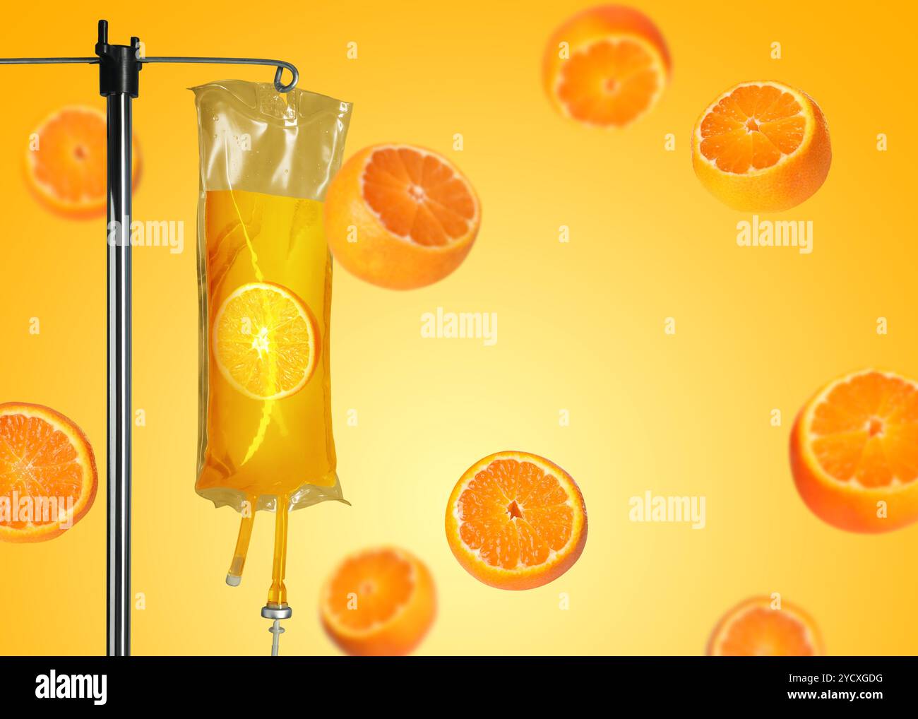 Vitamin intravenous therapy. IV infusion set and falling oranges on ...
