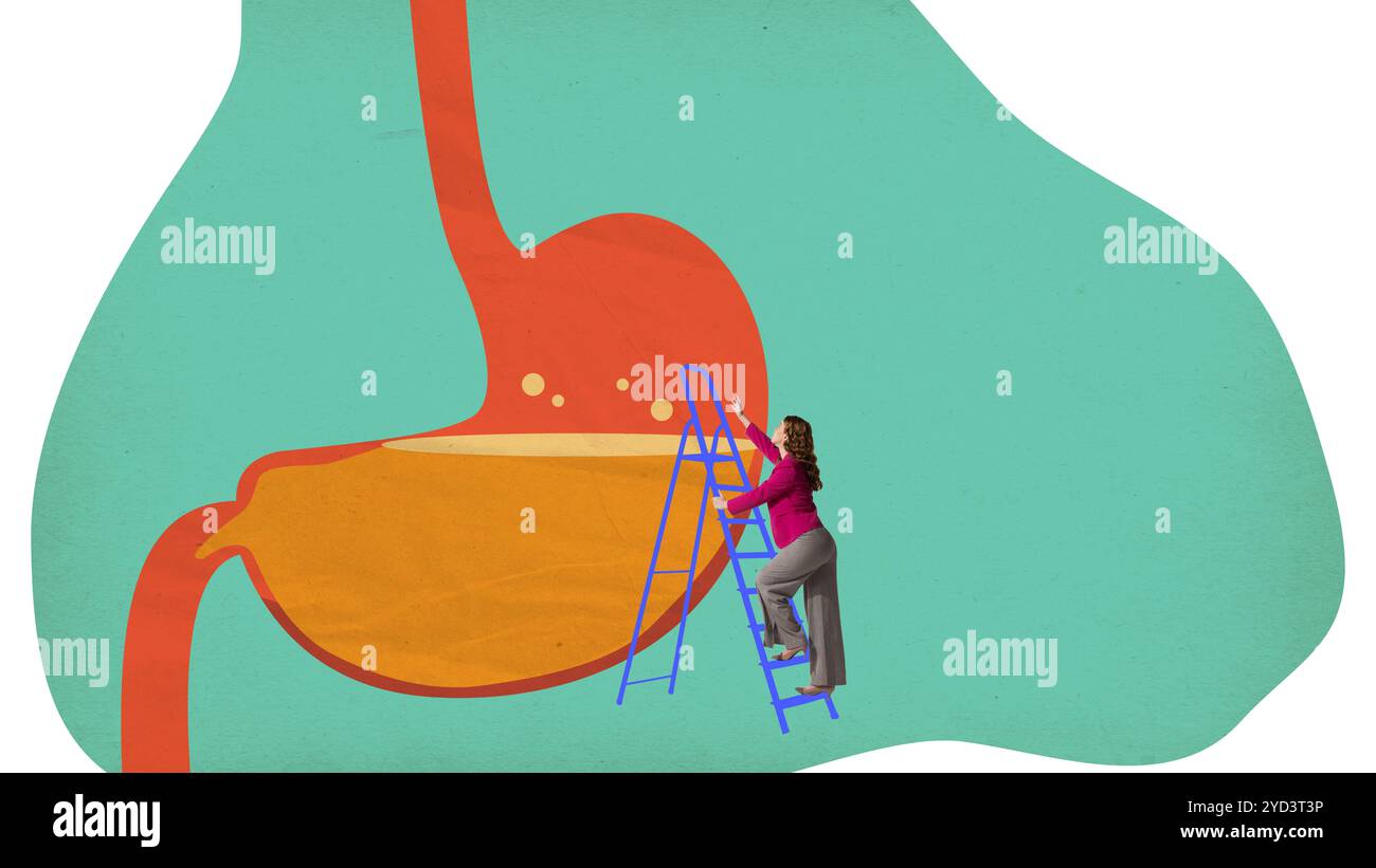 Illustration of stomach with acid reflux, highlighting issues with ...