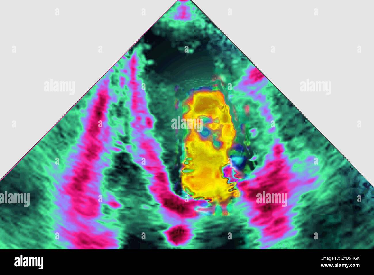 Echocardiography ultrasound hi-res stock photography and images - Alamy