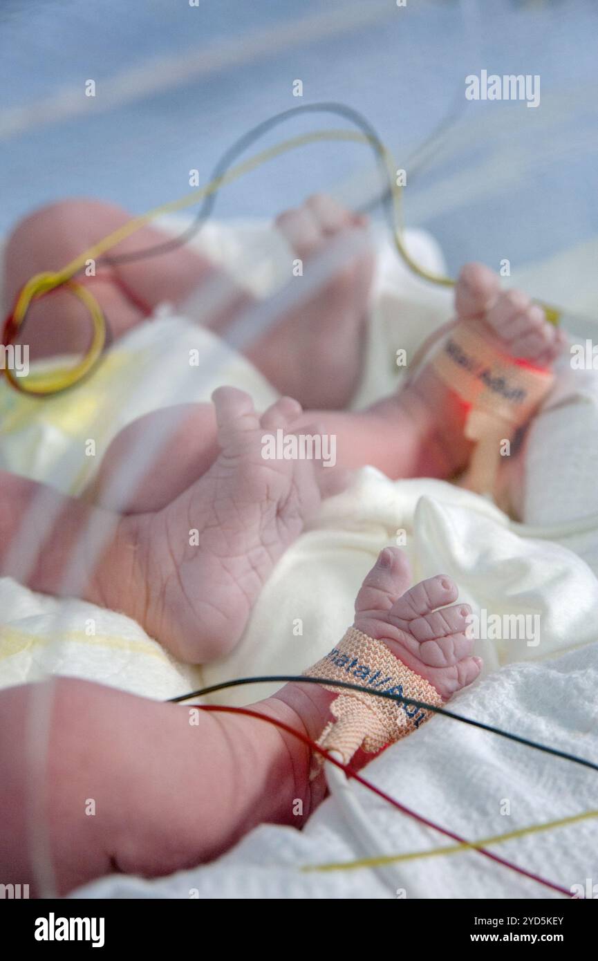 Premature baby in incubator foot hi-res stock photography and images ...