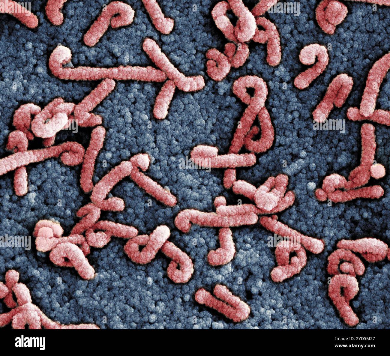 Colorized scanning electron micrograph of Marburg virus particles (red ...