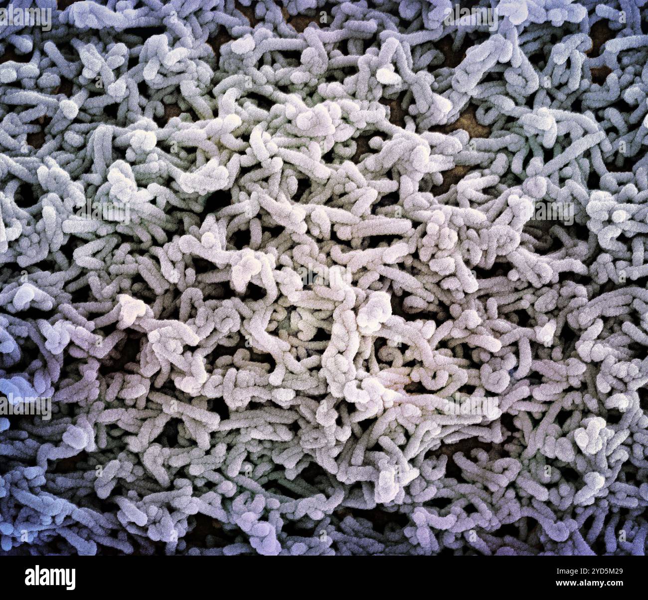 Colorized scanning electron micrograph of Marburg virus particles both ...