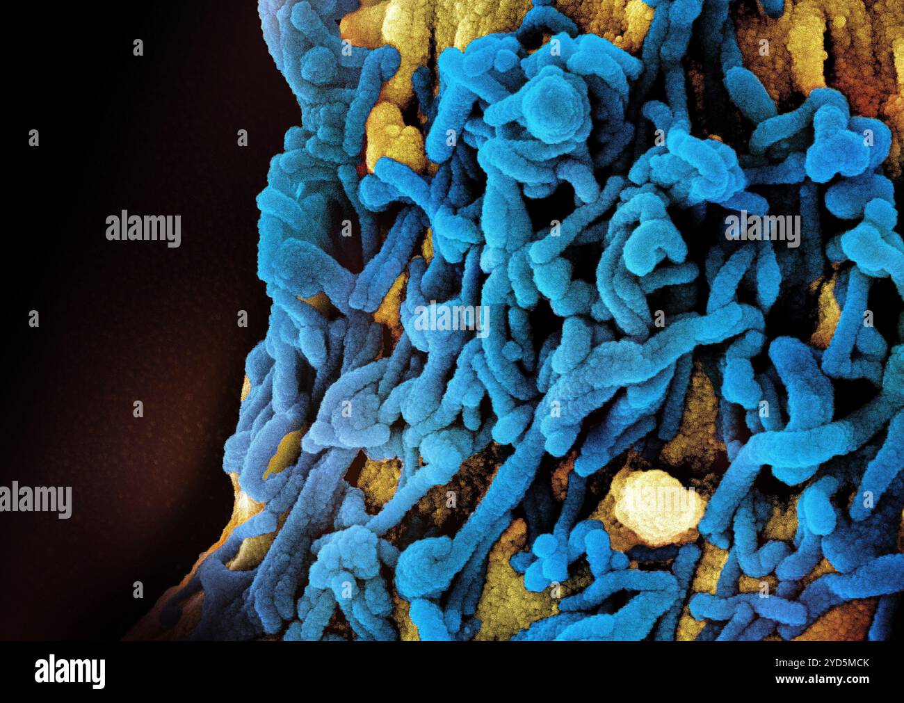 Colorized scanning electron micrograph of Marburg virus particles (blue ...