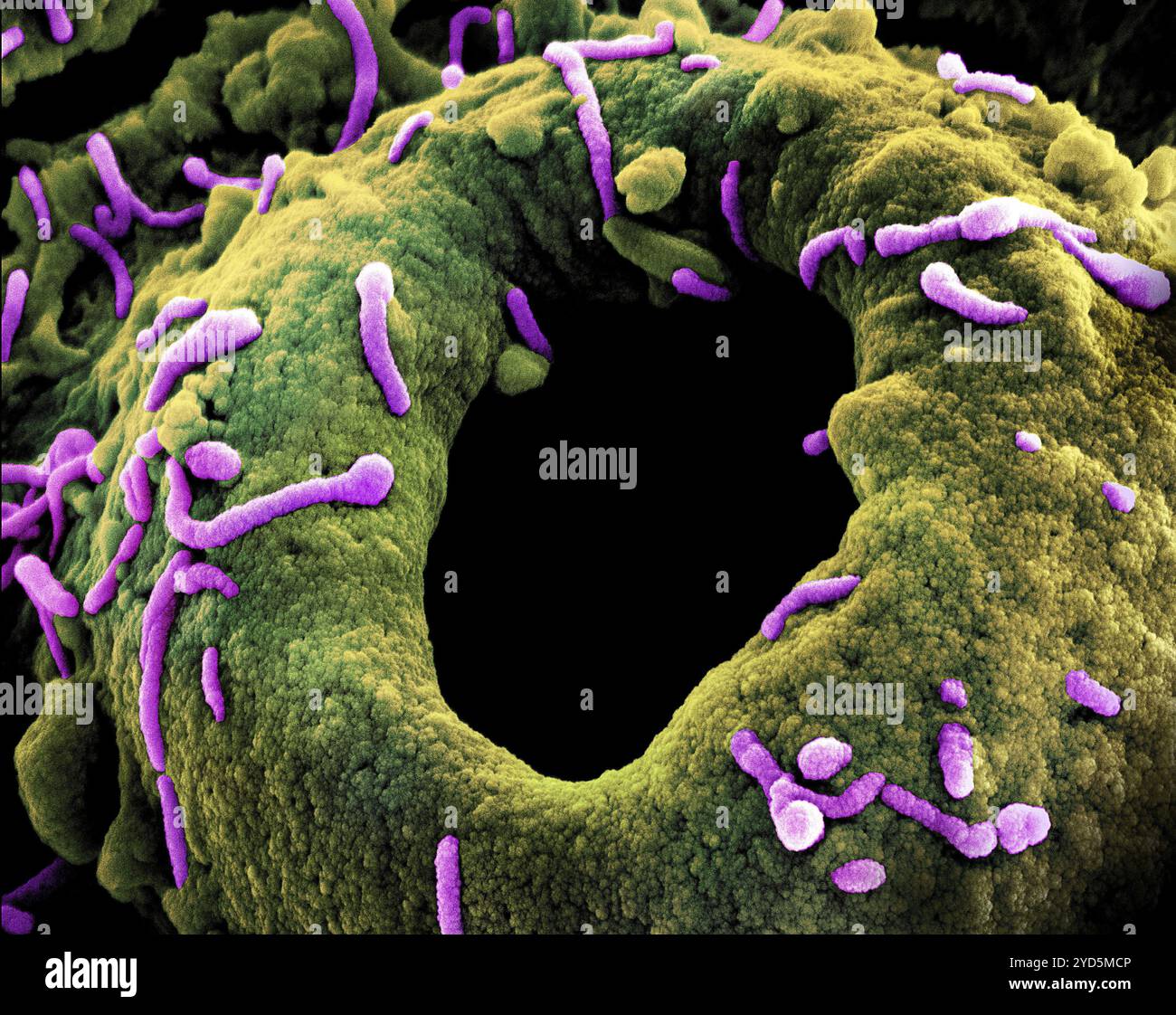 Colorized scanning electron micrograph of Marburg virus particles ...