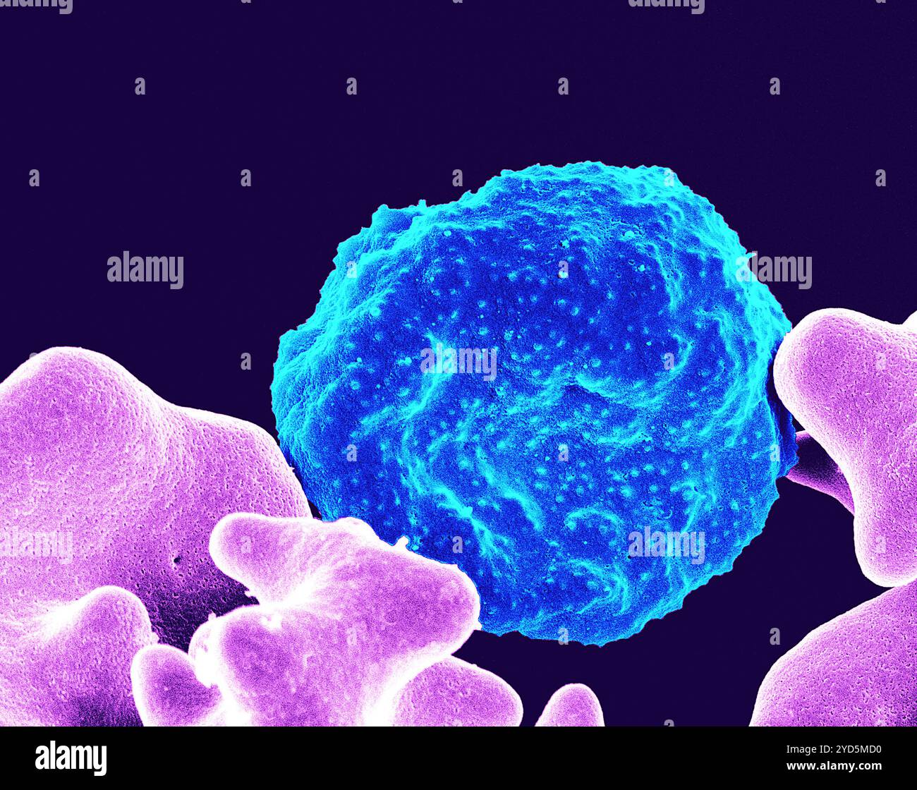 Colorized scanning electron micrograph of red blood cell infected with ...