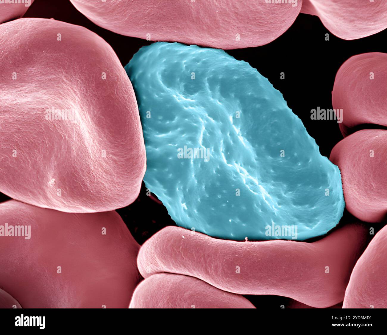 Colorized scanning electron micrograph of red blood cell infected with ...