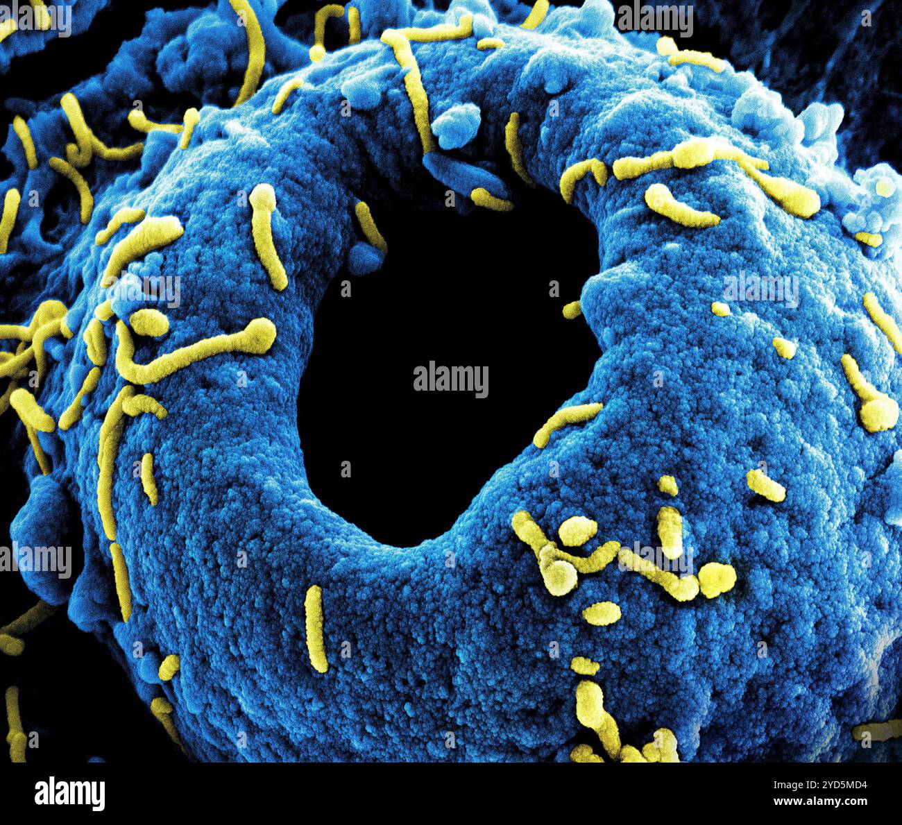Colorized scanning electron micrograph of Marburg virus particles ...