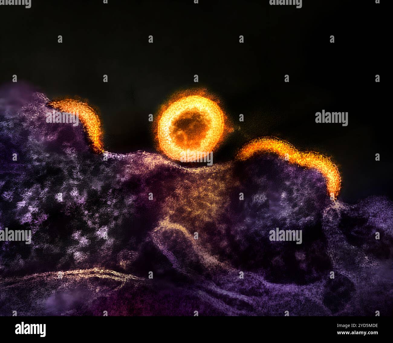 Transmission electron micrograph of HIV-1 virus particles (colorized ...