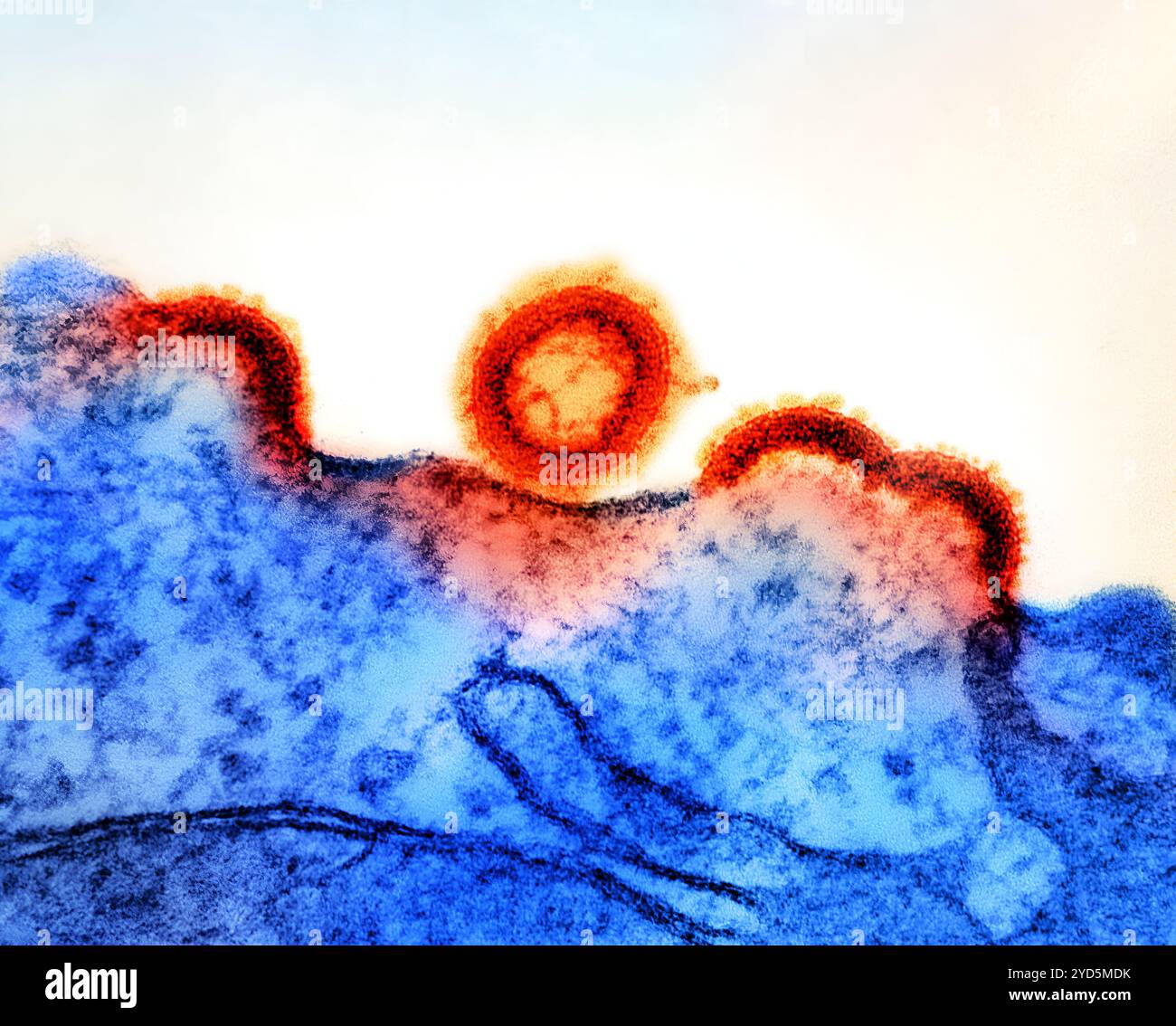 Transmission electron micrograph of HIV-1 virus particles (colorized ...